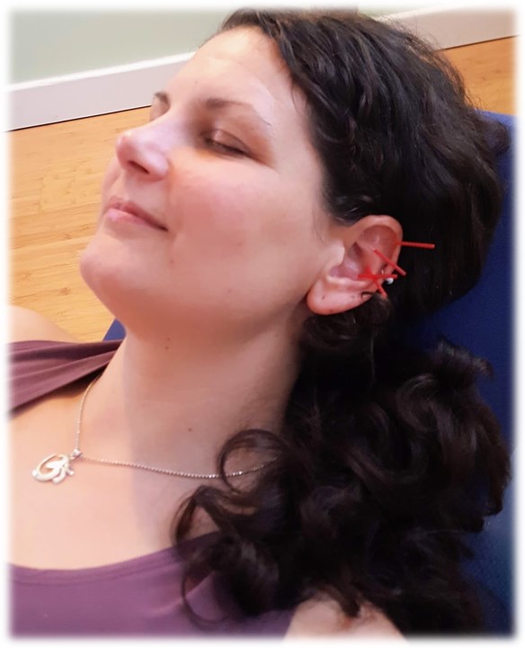 Acu-Yoga - Acupuncture Wellness of Holden, LLC